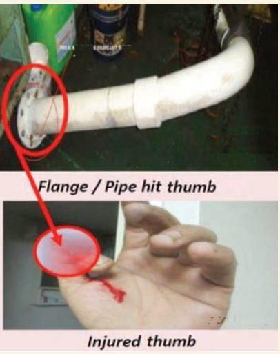 202070 Hand injury while dismantling pipe