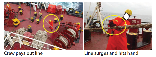 201963 Hand injury while mooring