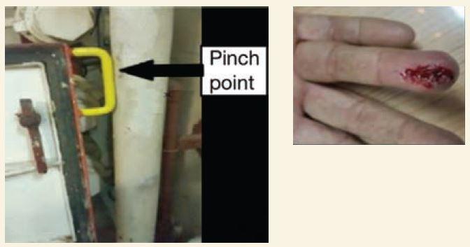 201817 Pinch point discovered the hard way