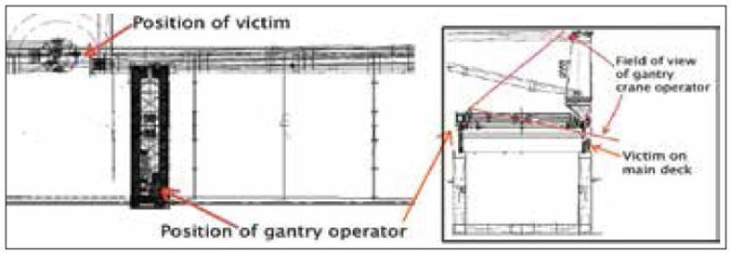 201525 Moving gantry causes serious injury